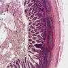 What Are Peyer's Patches and How Do They Protect Your Gut?